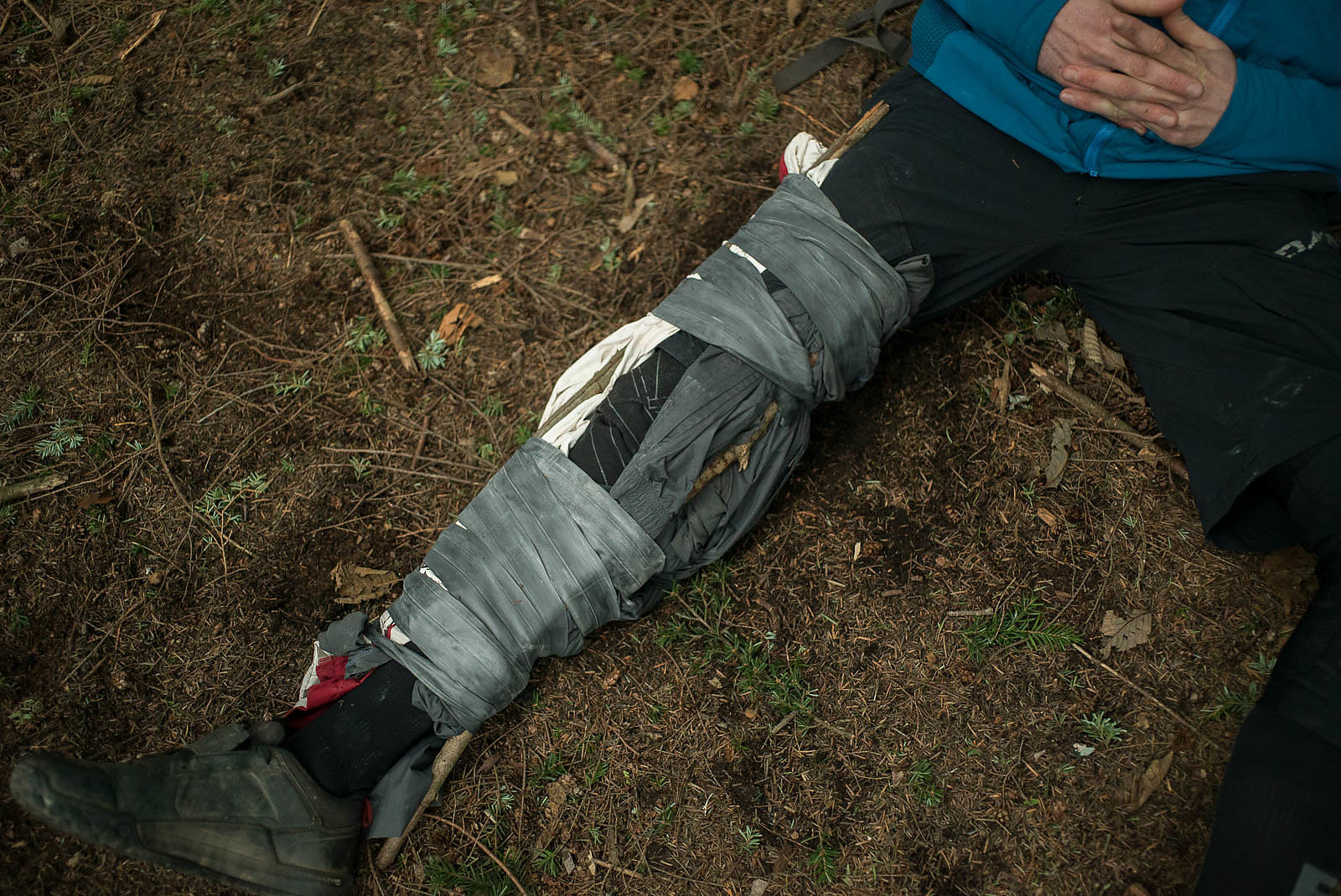 Orthopedic Injuries and Backcountry Splinting | Mountain Bike First Aid ...